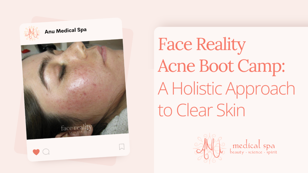 Face Reality Acne Boot Camp: A Holistic Approach to Clear Skin - Anu ...